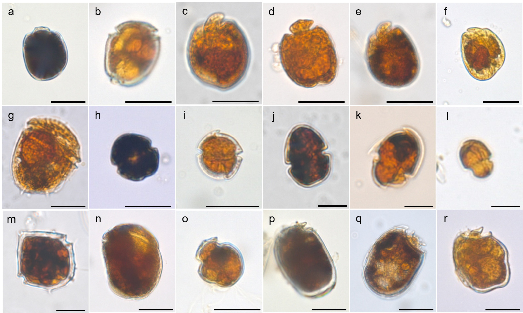 Characteristics of the Benthic Dinoflagellates Community in Pyoseon ...